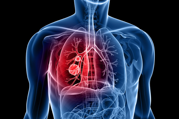 Dia Nacional de Conscientização e Divulgação da Fibrose Cística — Setor ...
