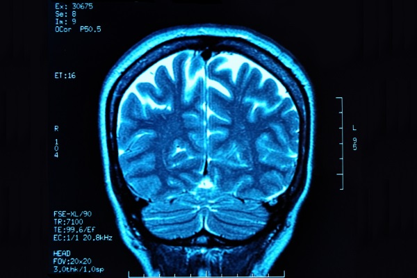 Anatomia do cérebro define se a pessoa é racional ou emocional — Setor ...