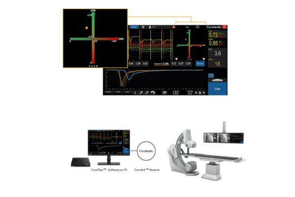 Abbott lança no Brasil a plataforma CoroFlow‡ — Setor Saúde
